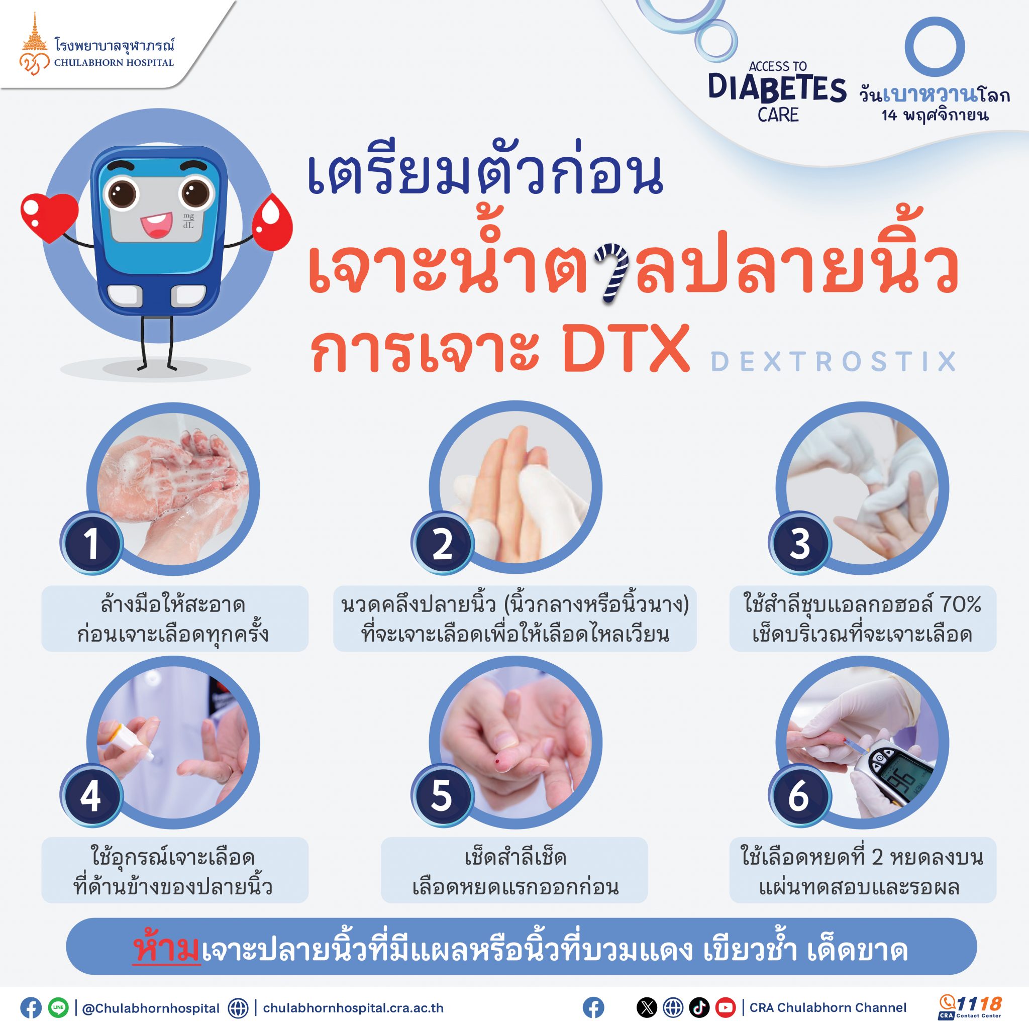เตรียมตัวก่อนเจาะน้ำตาลปลายนิ้ว DTX (DEXTROSTIX) - Chulabhorn Channel